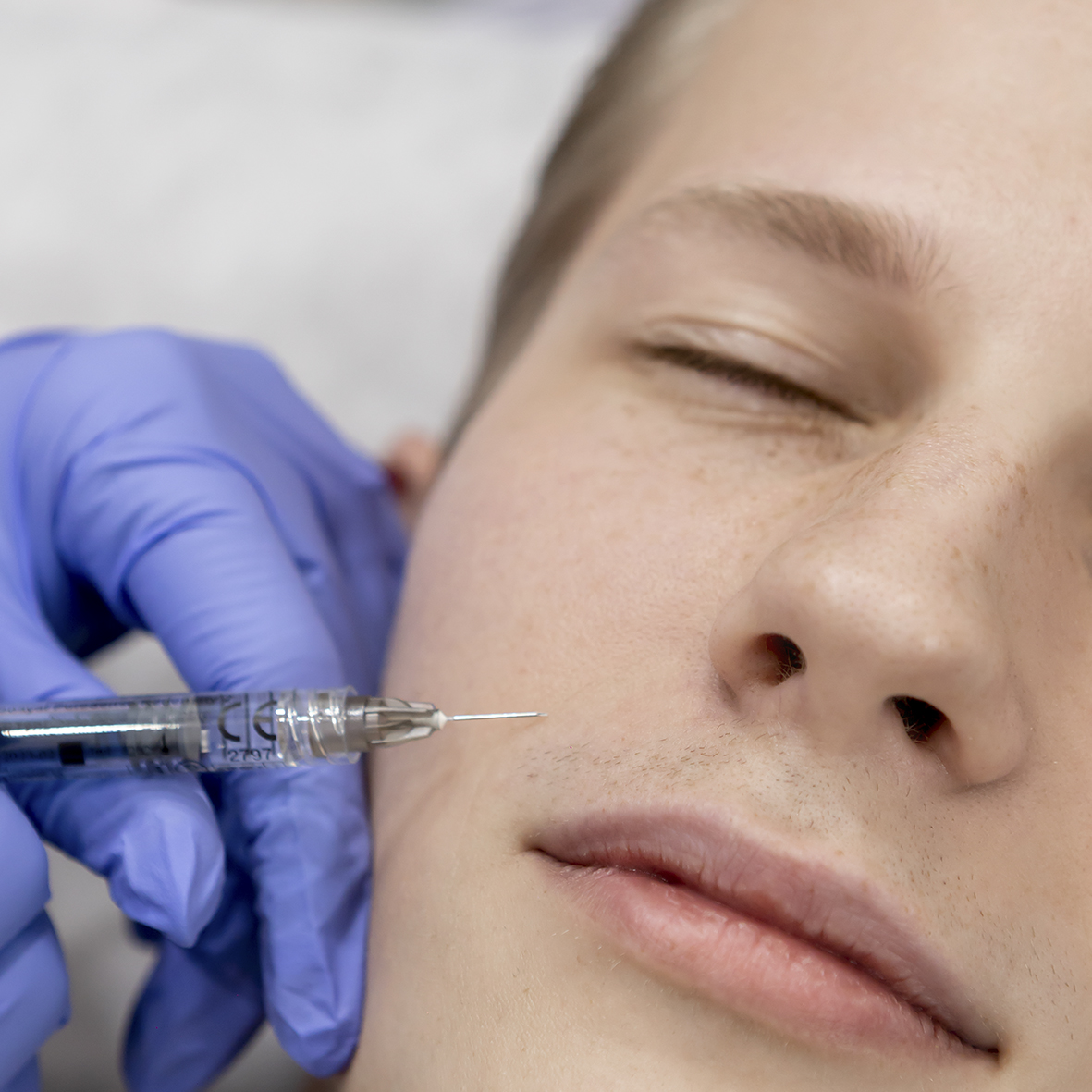 Lucent Filler - Lucent Clinic Indonesia